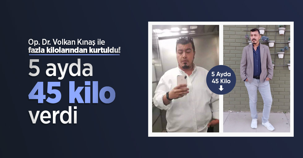 Op. Dr. Volkan Kınaş ile fazla kilolarından kurtuldu! 5 ayda 45 kilo verdi - Samsun Haber ...